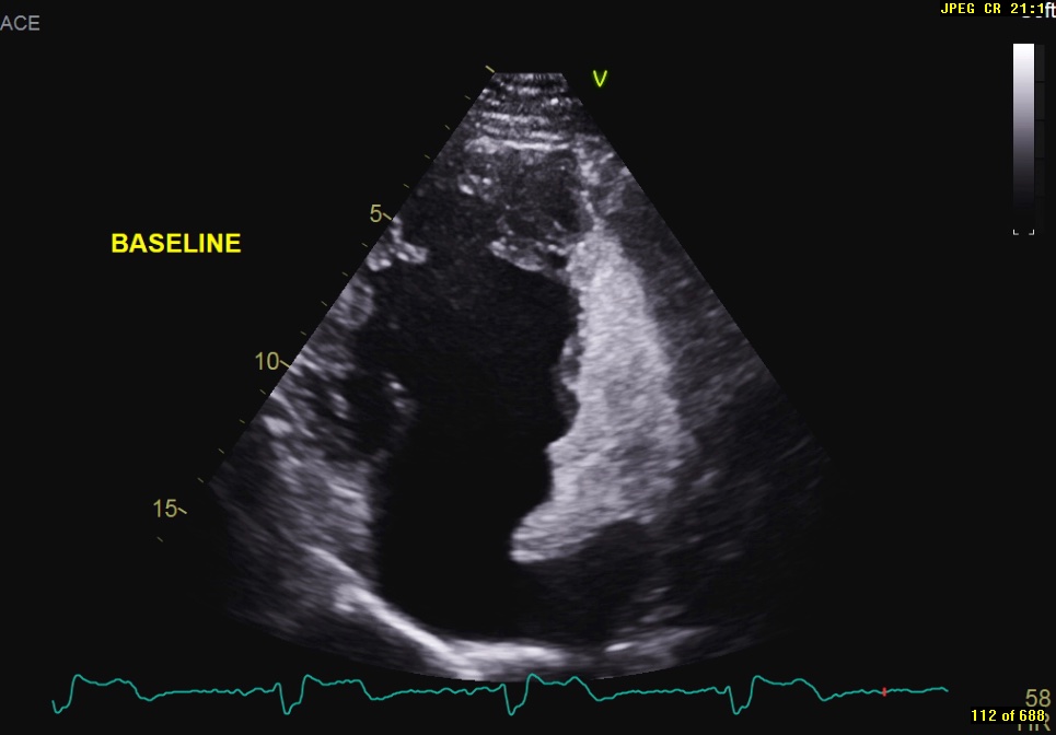 Image of the Month October 2021 - Value of an agitated saline bubble ...