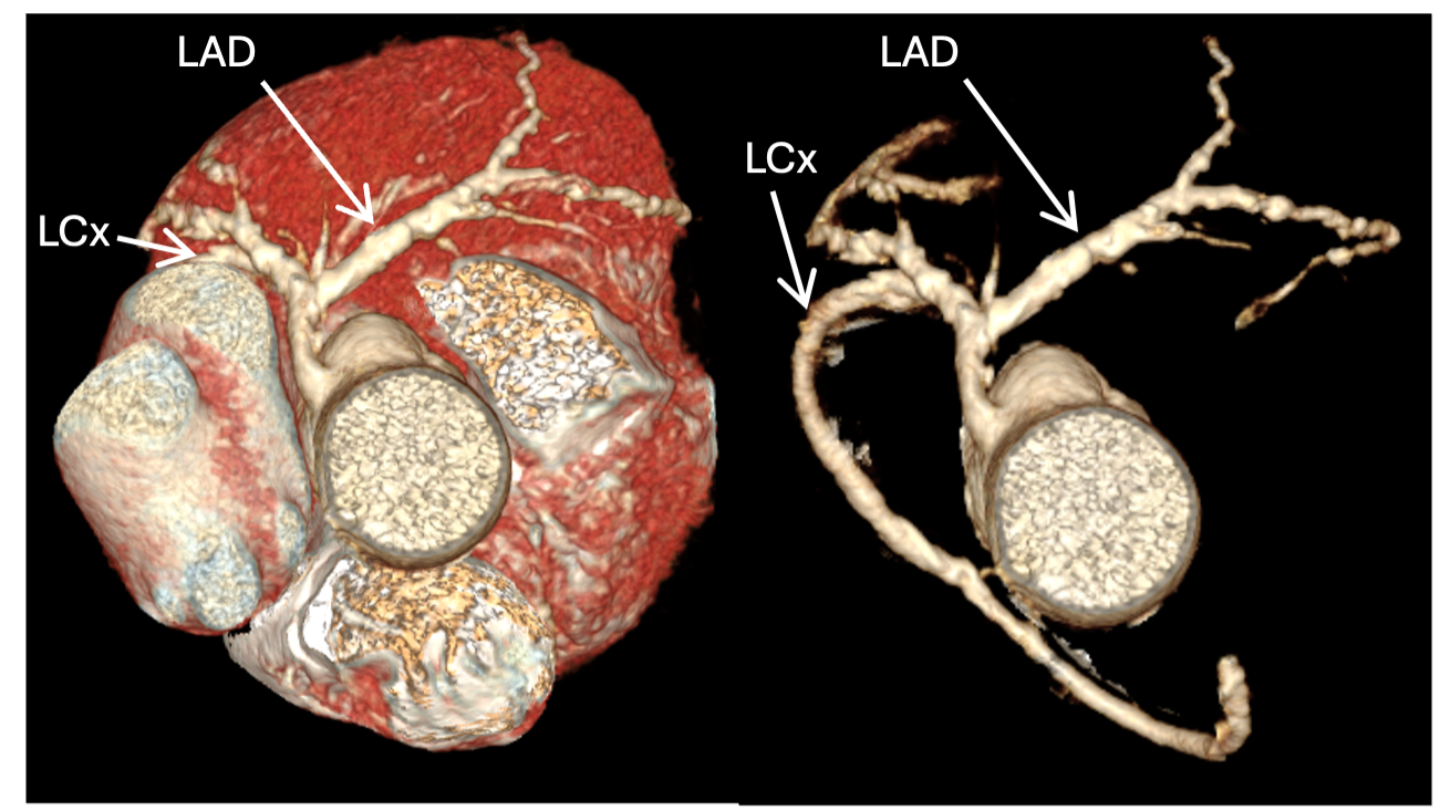 Images of the Month January 2025: Incidental finding of congenital ...