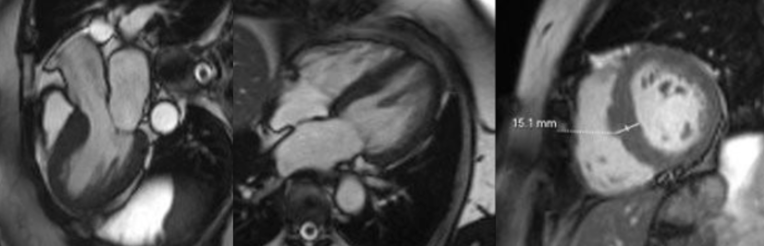 Image of the Month January 2026: A rare cause of concentric left ...