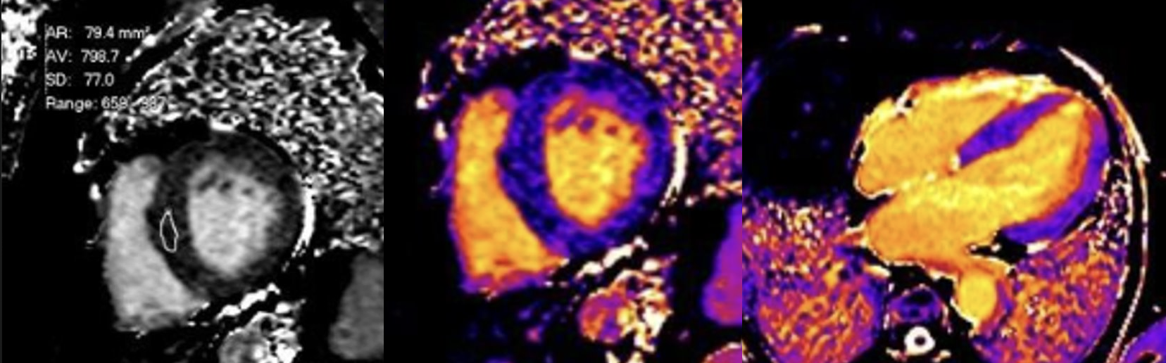 Image of the Month January 2026: A rare cause of concentric left ...